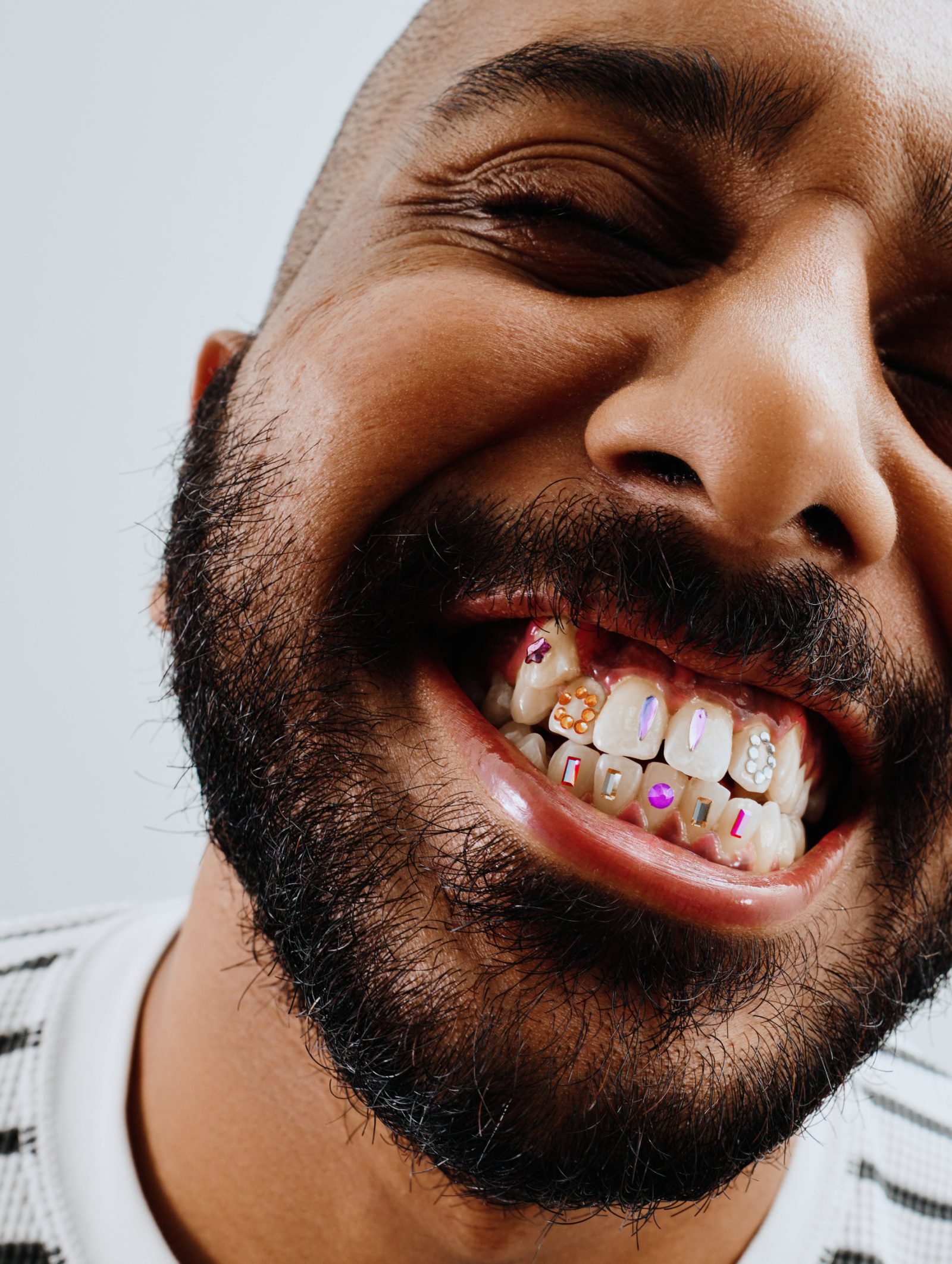 The Tooth Gems Trend Has Some Serious Bite: Here's Why You Should Try ...